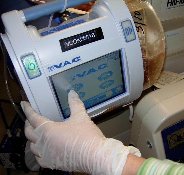 Wound Vac In Home Health Care PROFESSIONAL HOME CARE SERVICES INC Wound Vac In Home Health Care PROFESSIONAL HOME CARE SERVICES INC